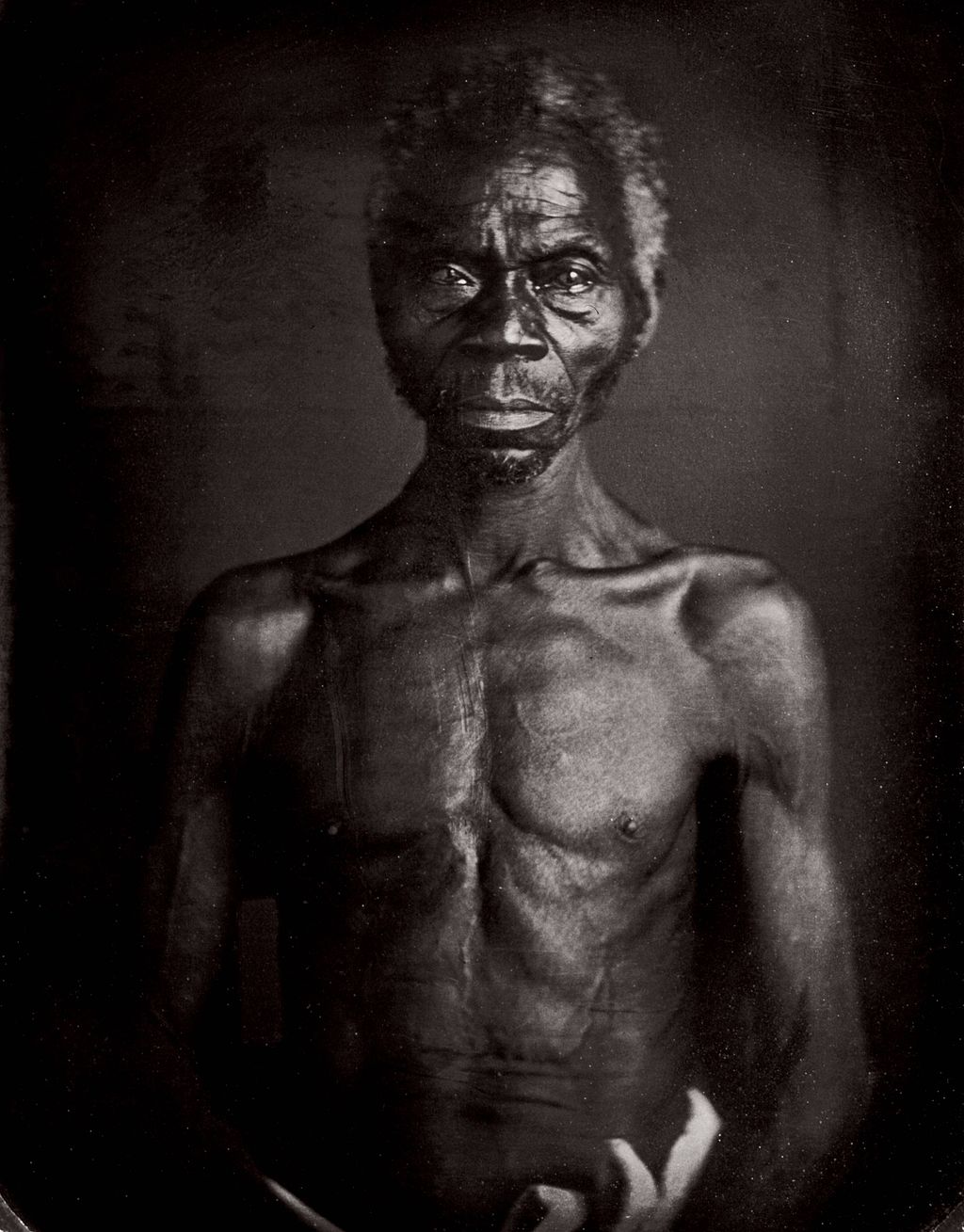 Harvard profited from photos of slaves, descendant says in lawsuit ...