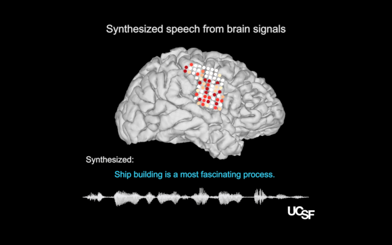 Scientists get one step closer to decoding thoughts into speech | PBS News
