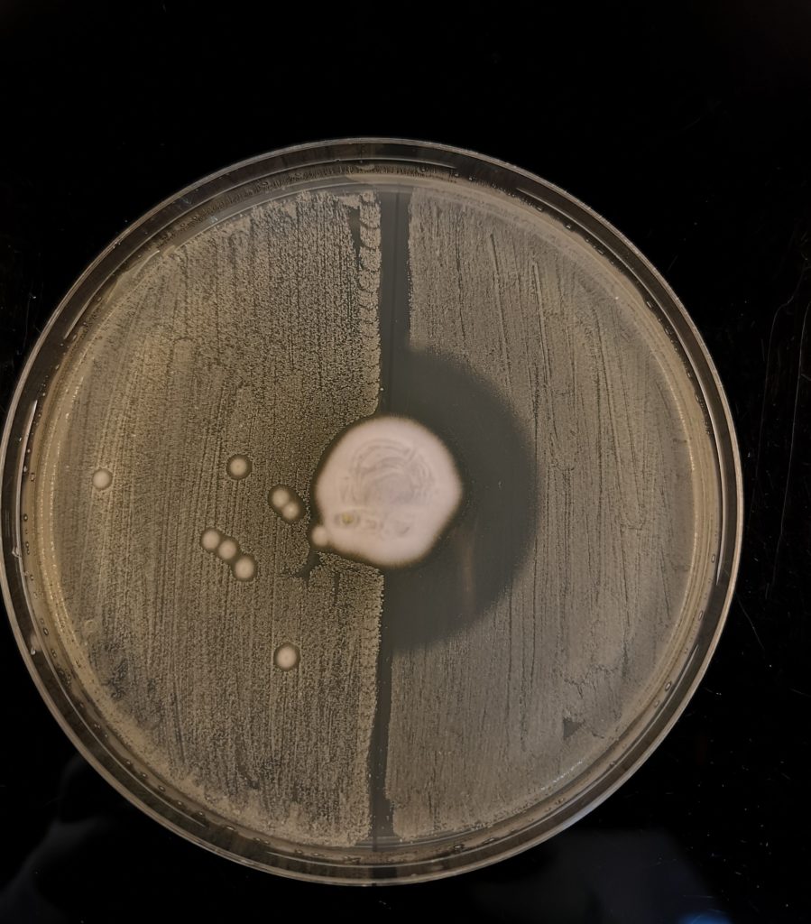 Hedgehogs are the cutest reminder that we shouldn't overuse antibiotics ...