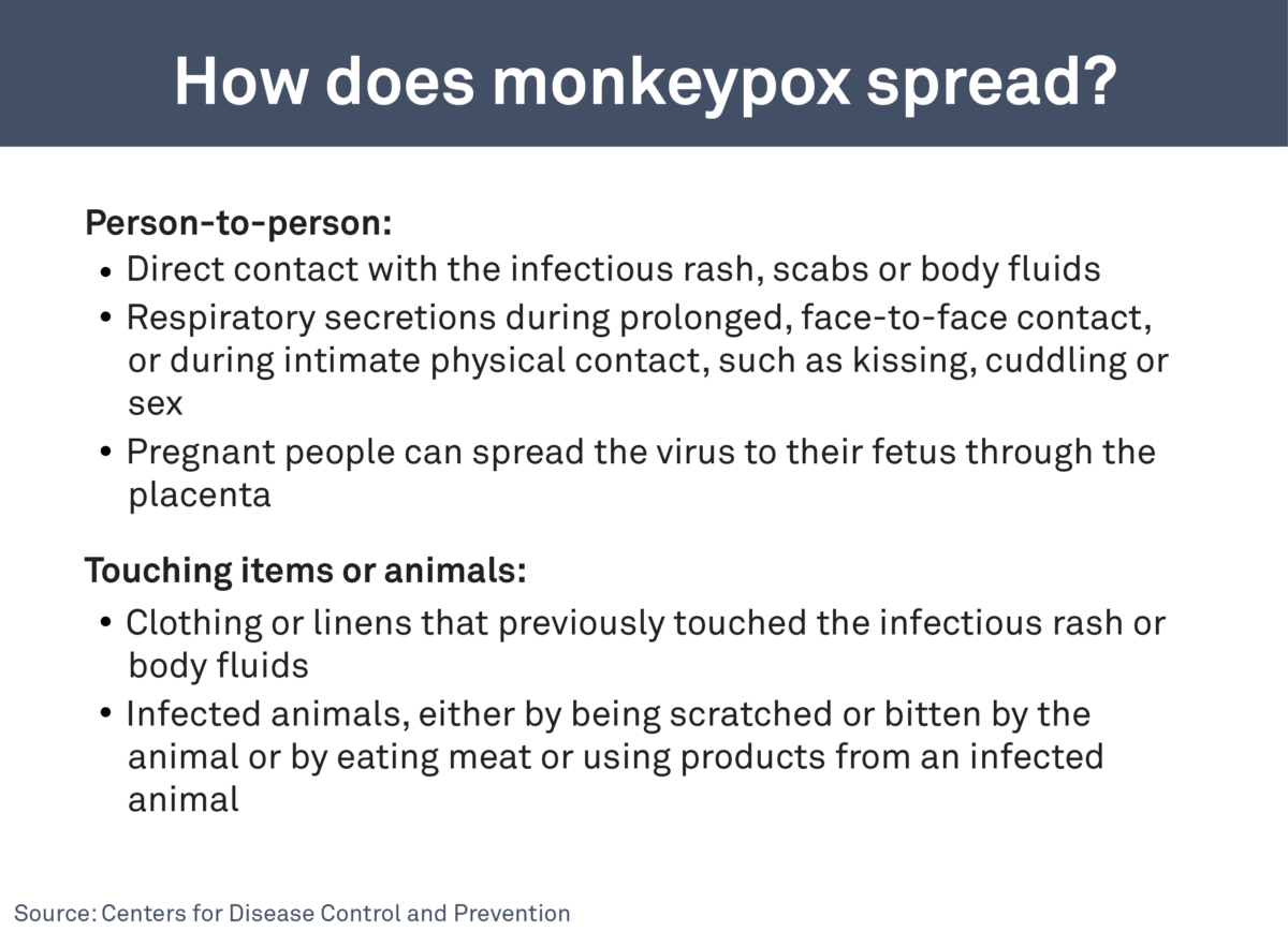 What are monkeypox symptoms? Here’s what you need to know | PBS News