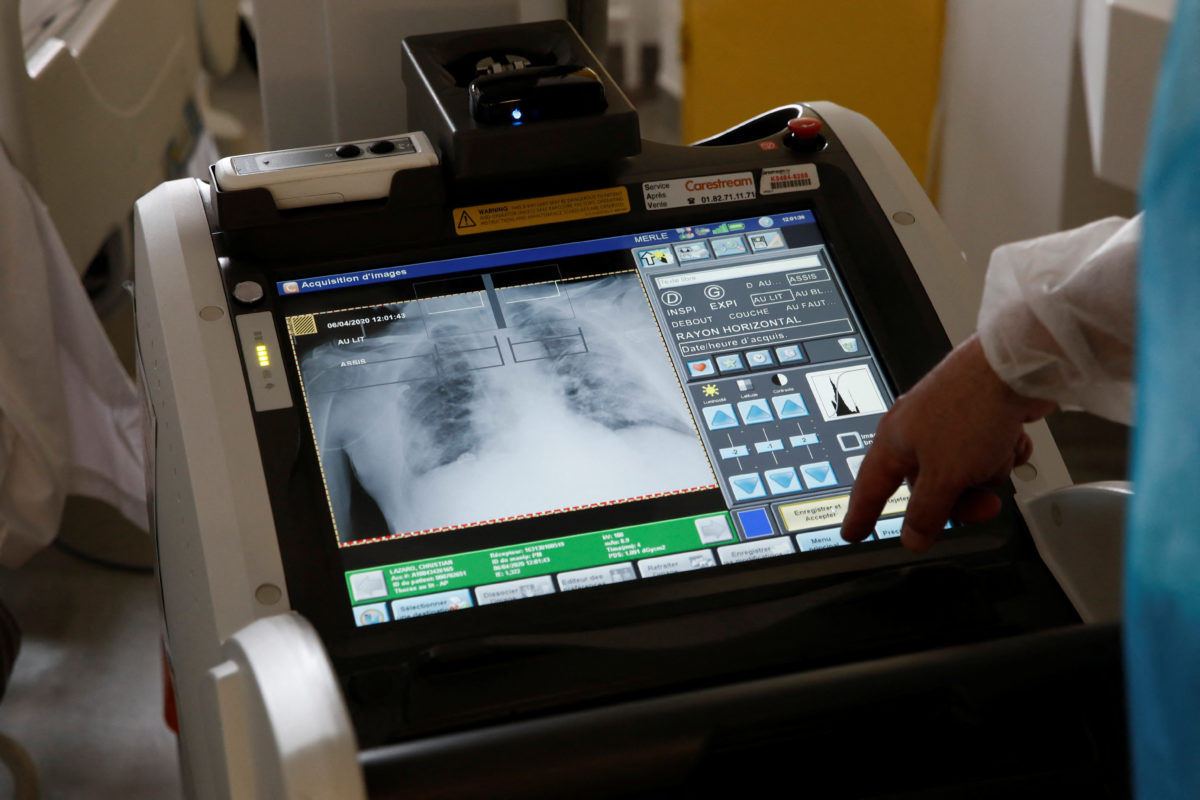 Scientists are piecing together the puzzle of long COVID. Here’s what ...