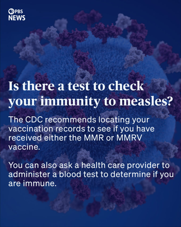 Do adults need a measles booster? An epidemiologist explains who is immune | PBS News