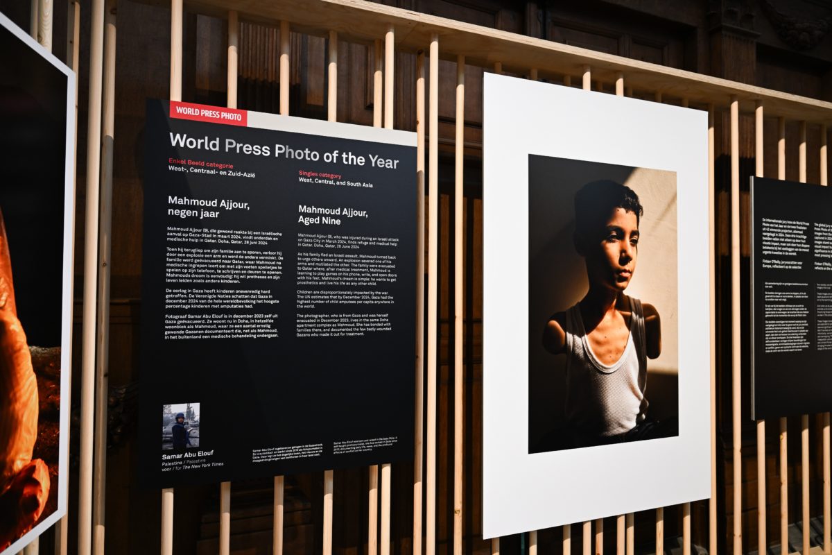 Portrait of Palestinian boy who lost both arms is 2025 World Press ...