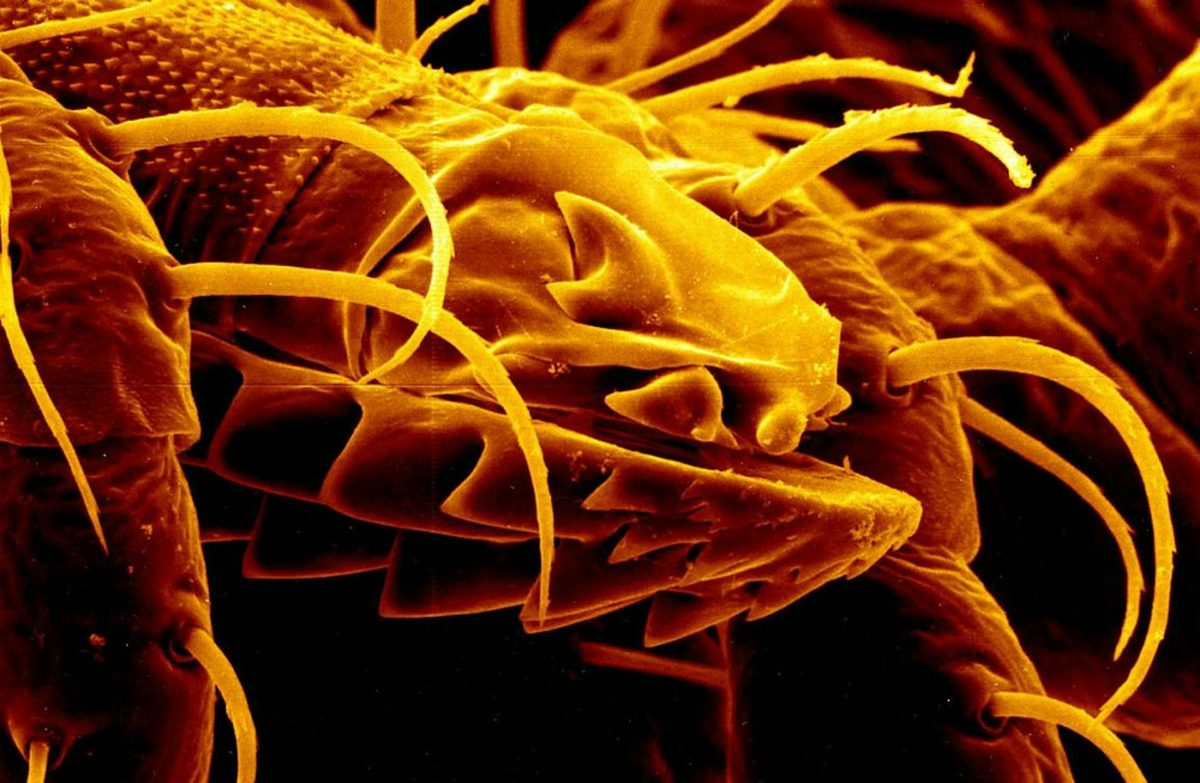 What to know about alpha-gal syndrome, a red meat allergy caused by ...