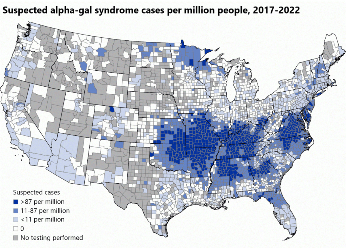 What to know about alpha-gal syndrome, a red meat allergy caused by ...